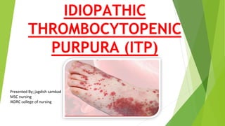 IDIOPATHIC THROMBOCYTOPENIC PURPURA (ITP) | PPT