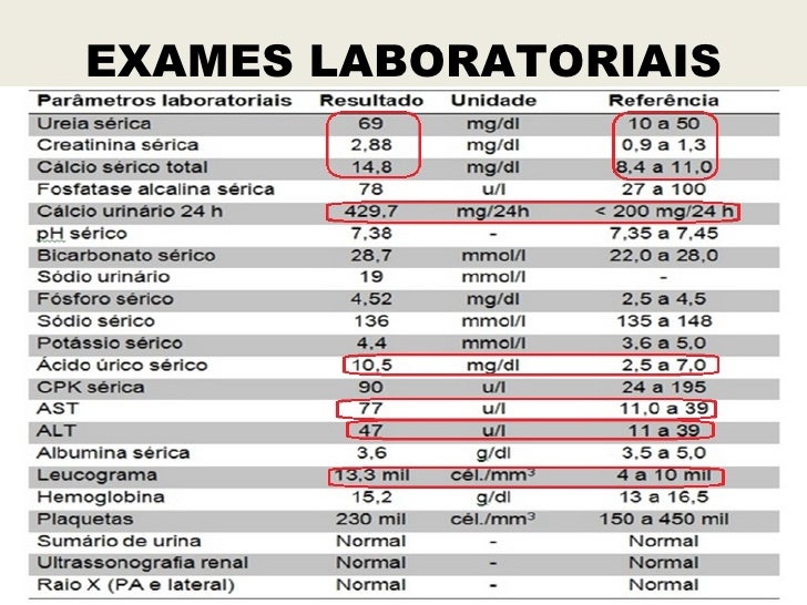 Seminário (Insuficiência Renal Aguda e Crônica)