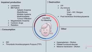 ITP and SLE Clinical case presentation by Pamudith Karunaratne | PPSX