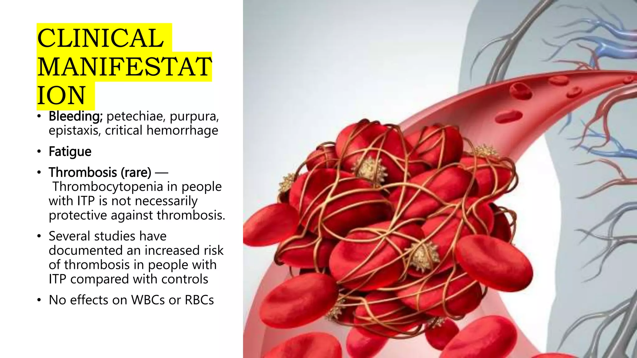 ITP (Immune Thrombocytopenia) | PPTX