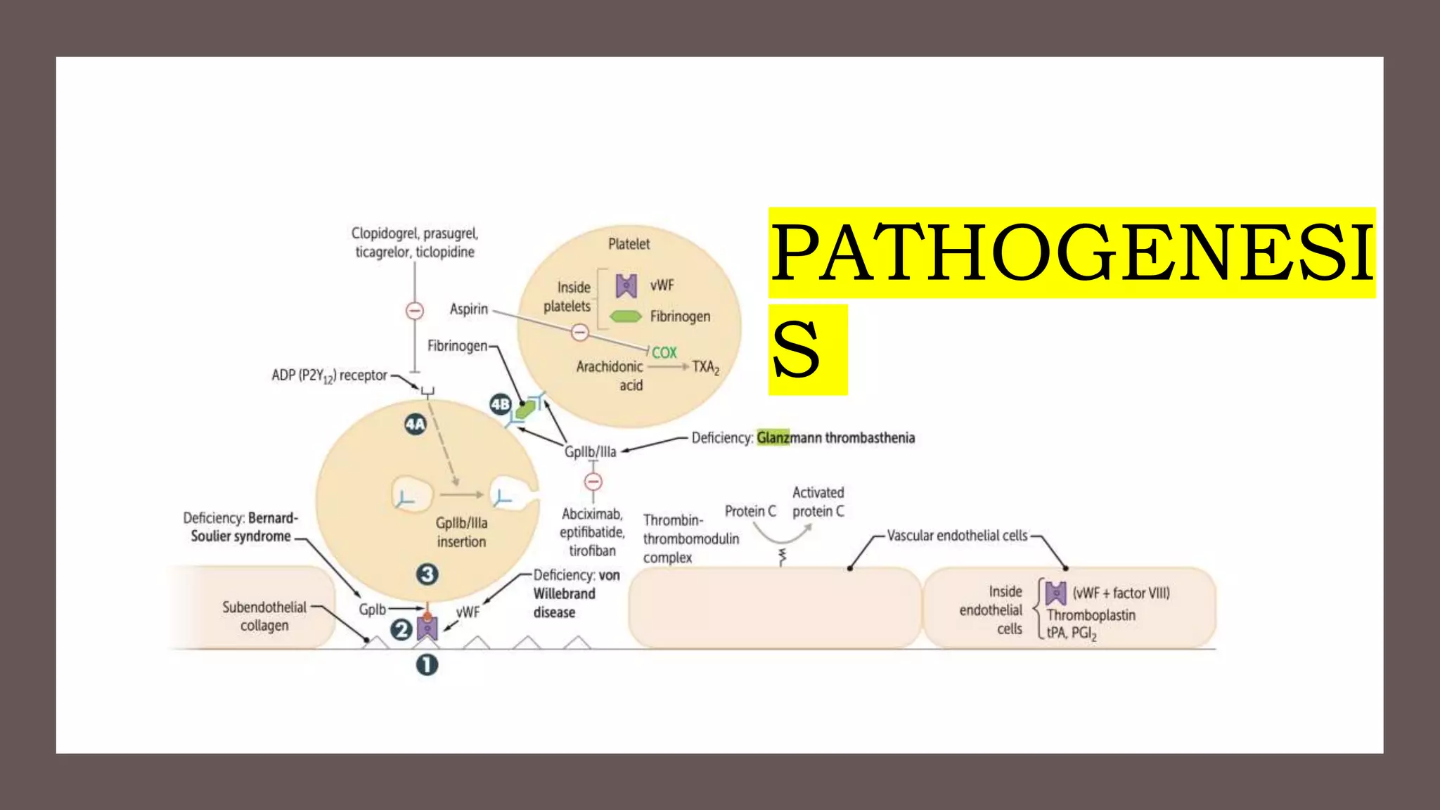 ITP (Immune Thrombocytopenia) | PPTX