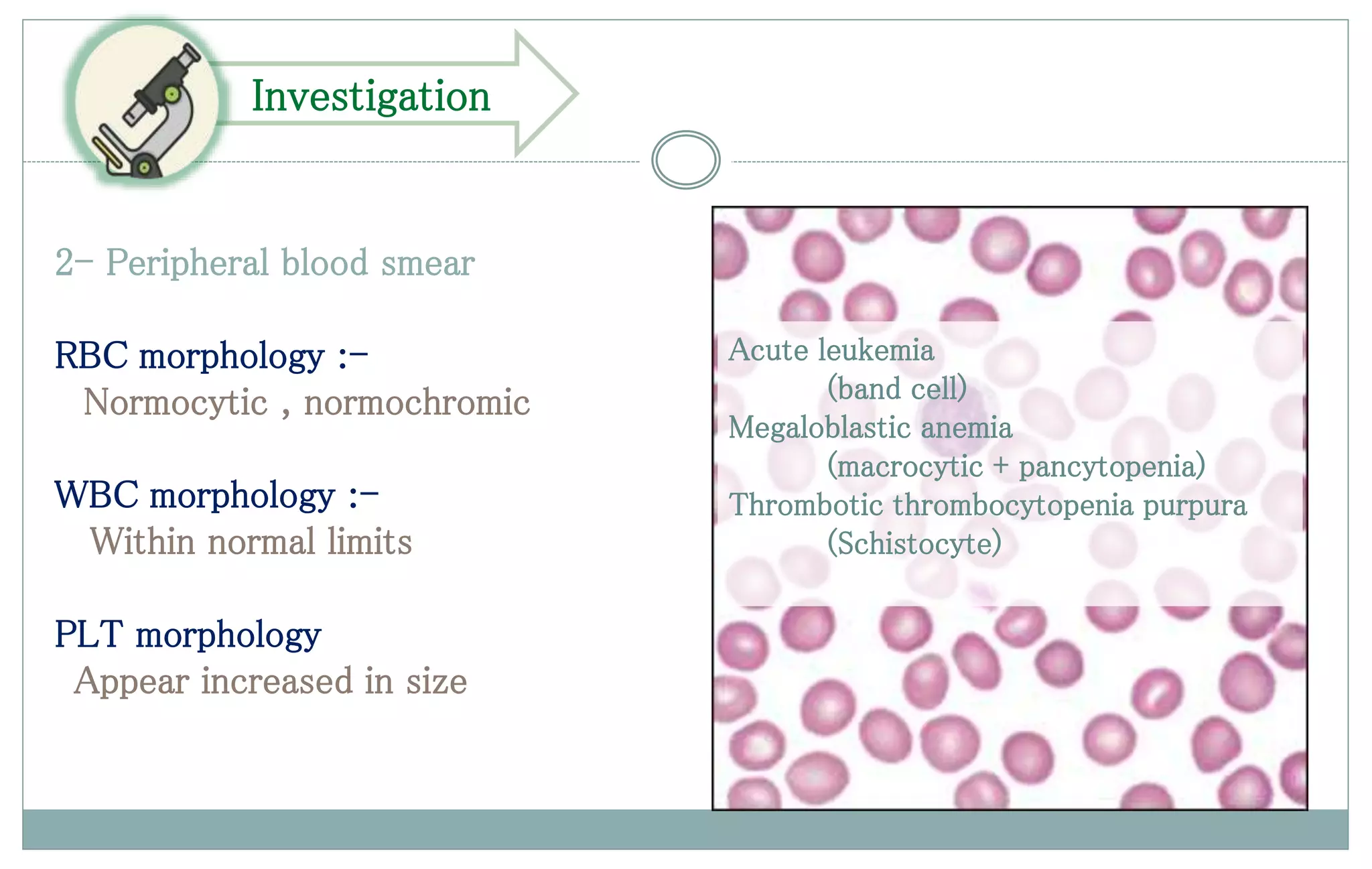 Idiopathic thrombocytopenic purpura | PPTX