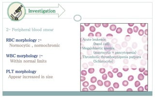 Idiopathic Thrombocytopenic Purpura Smear