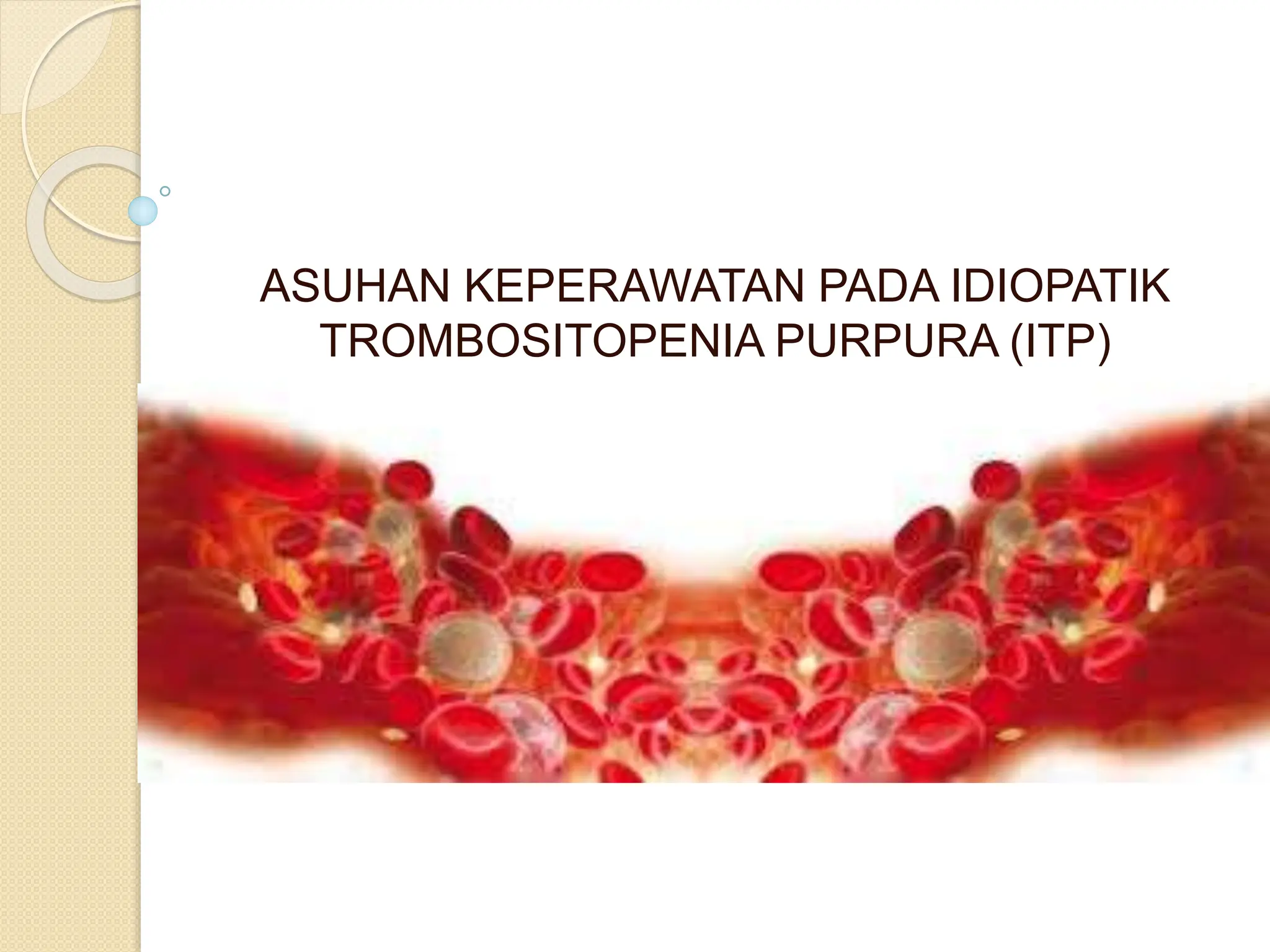 ITP ( Idiopatik Trombositopenia Purpura)(1).pptx