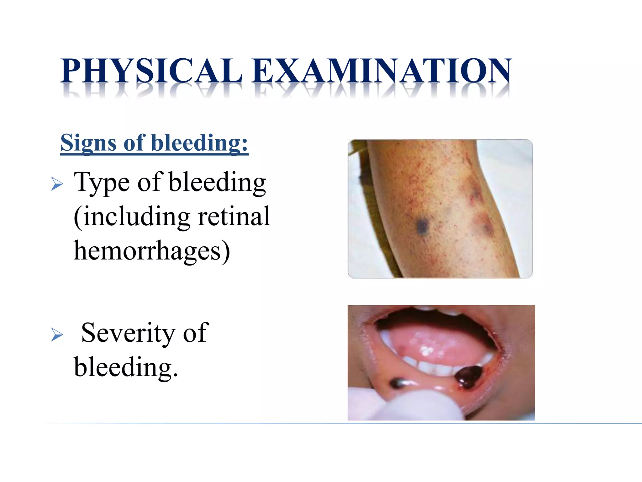 Immune Thrombocytopenia (ITP) | PPTX