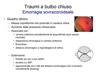 I traumi del segmento posteriore | PPT | Death, Injury, or Military ...