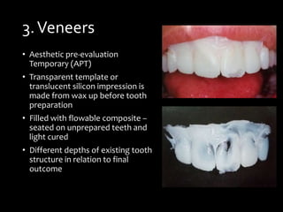 Interim and Temporary restorations | PPTX