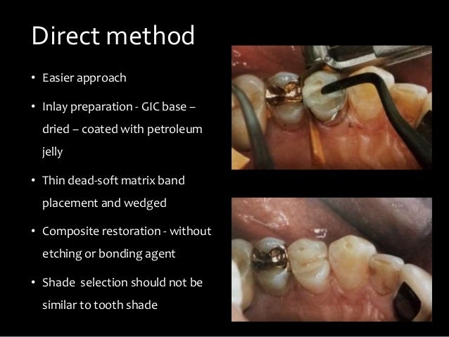 Interim and Temporary restorations