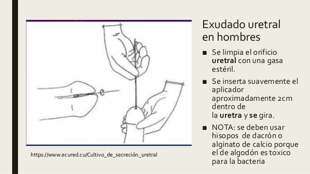 Diagnostico De Laboratorio De Neisseria Gonorrhoeae Y Treponema Palli