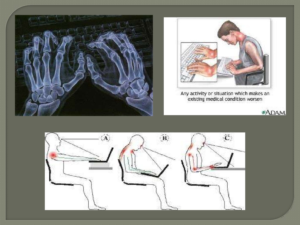 computer related health hazards