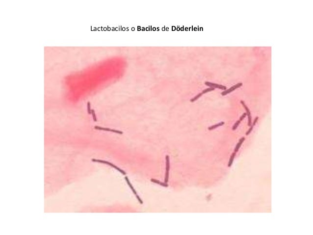 Its uretritis y cervicitis