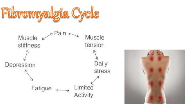 Fibromyalgia-wide spread pain | PPT