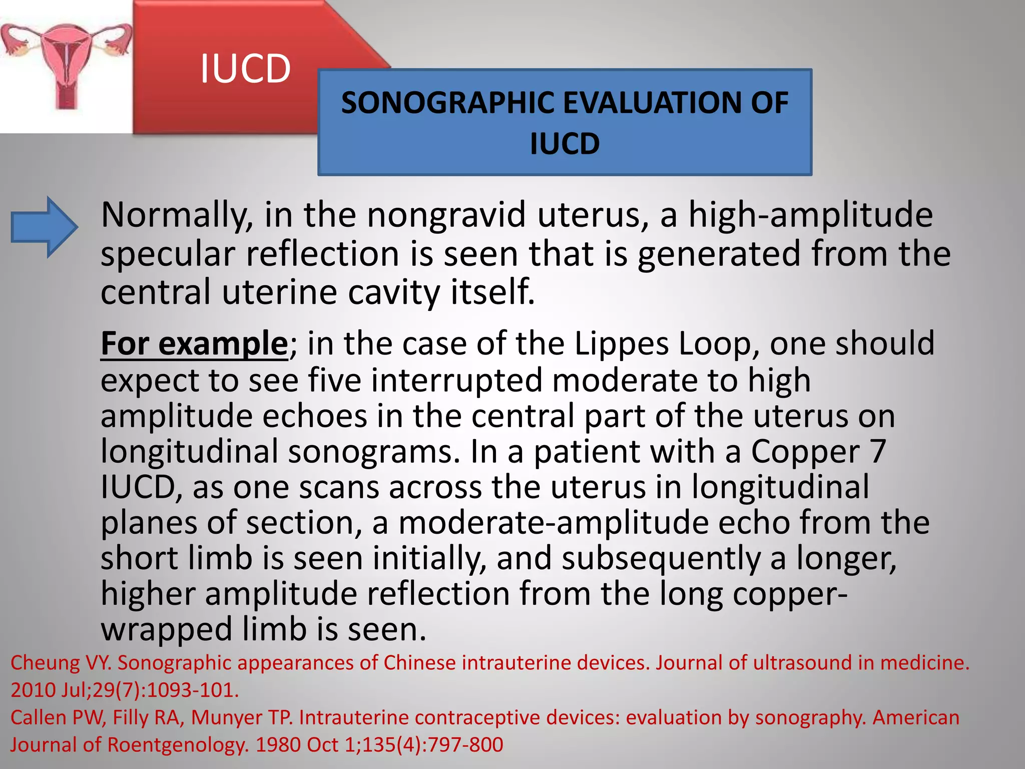 Role of Ultrasound in the assessment of Intrauterine Contraceptive ...