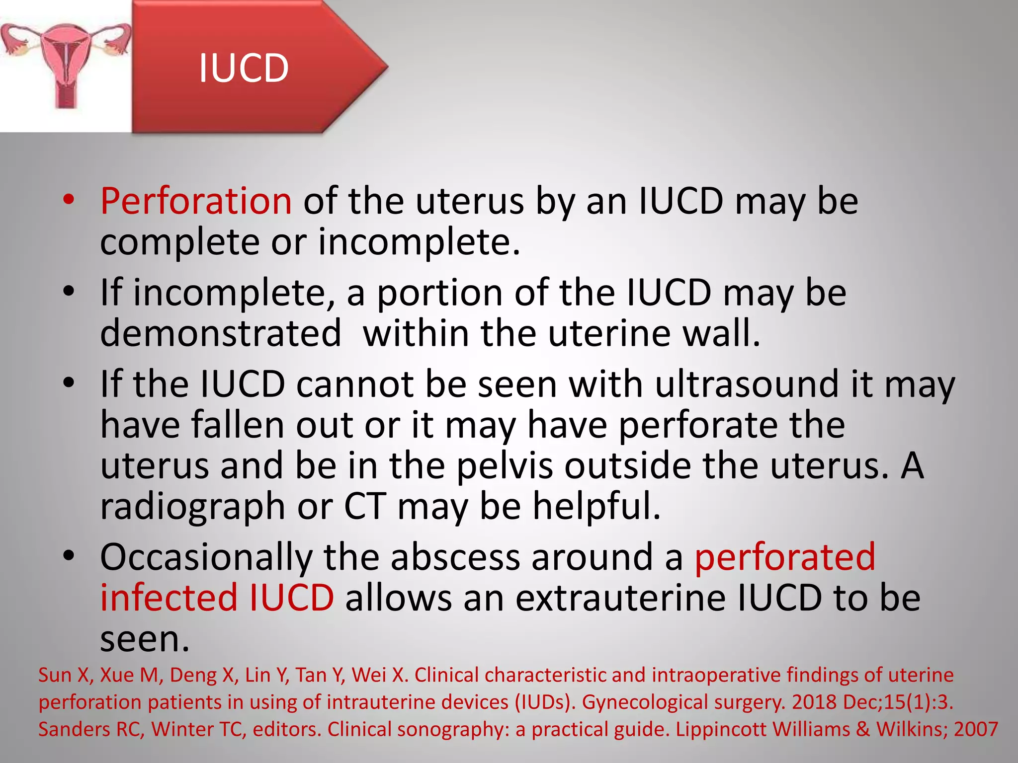 Role of Ultrasound in the assessment of Intrauterine Contraceptive Devices (IUCD) | PPTX