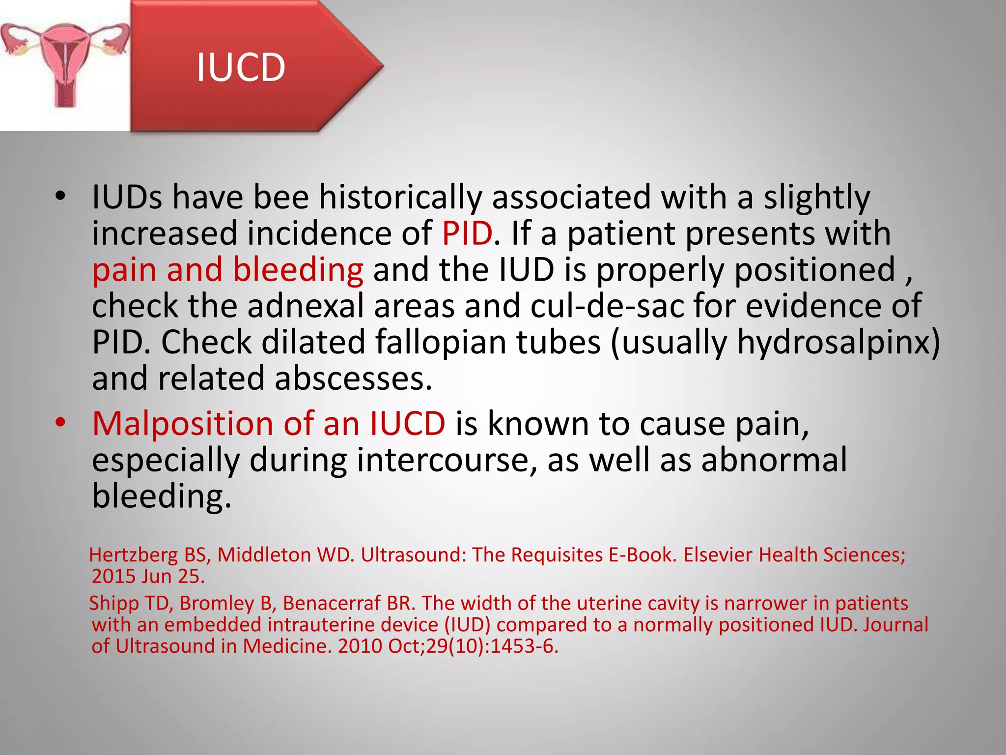 Role of Ultrasound in the assessment of Intrauterine Contraceptive ...