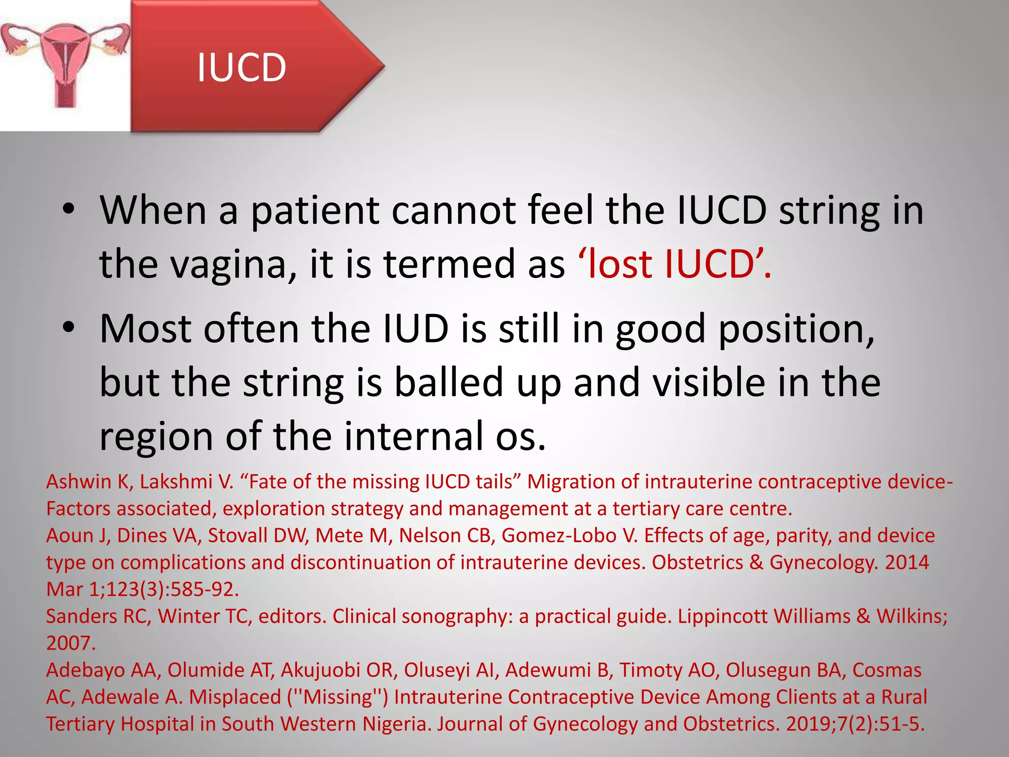 Role of Ultrasound in the assessment of Intrauterine Contraceptive ...