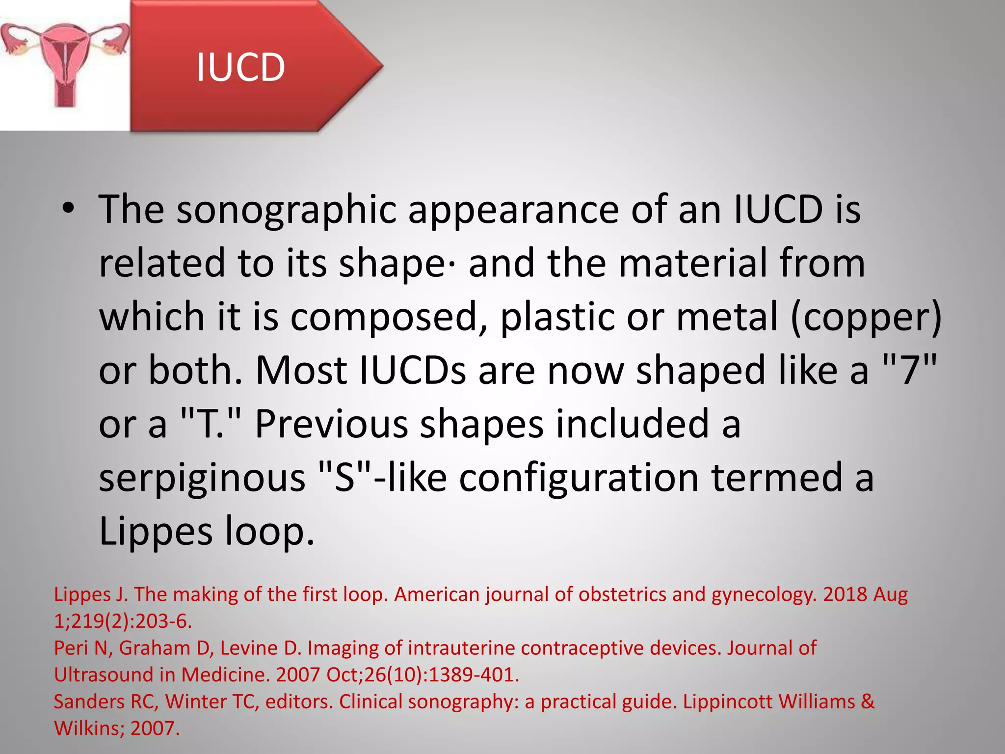 Role of Ultrasound in the assessment of Intrauterine Contraceptive ...