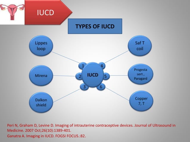 Role of Ultrasound in the assessment of Intrauterine Contraceptive ...