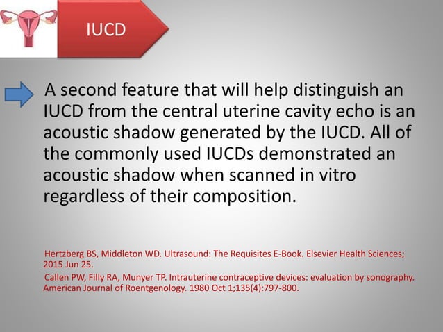 Role of Ultrasound in the assessment of Intrauterine Contraceptive ...
