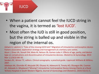 Role of Ultrasound in the assessment of Intrauterine Contraceptive ...