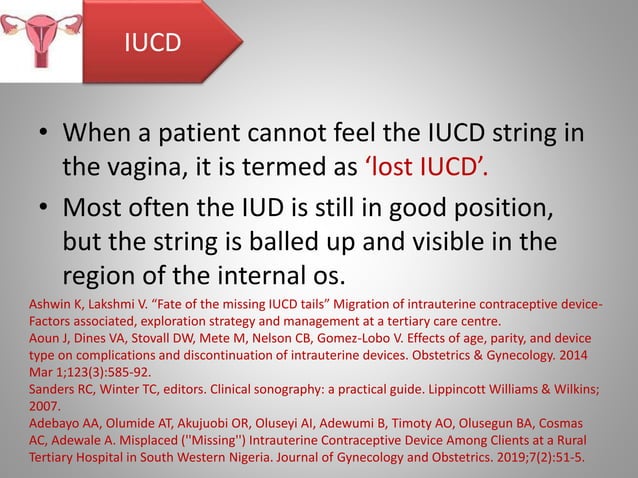 Role of Ultrasound in the assessment of Intrauterine Contraceptive ...