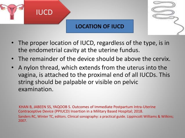 Role of Ultrasound in the assessment of Intrauterine Contraceptive ...
