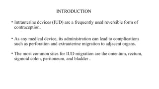 IUCD bladder stone and its further management | PPT