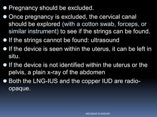 IUCD: Uterine perforation | PDF
