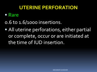IUCD: Uterine perforation | PDF