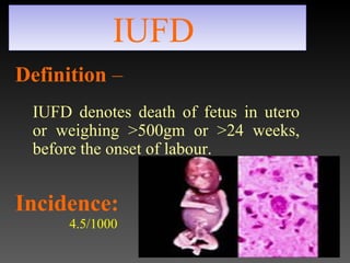 Iud | PPT