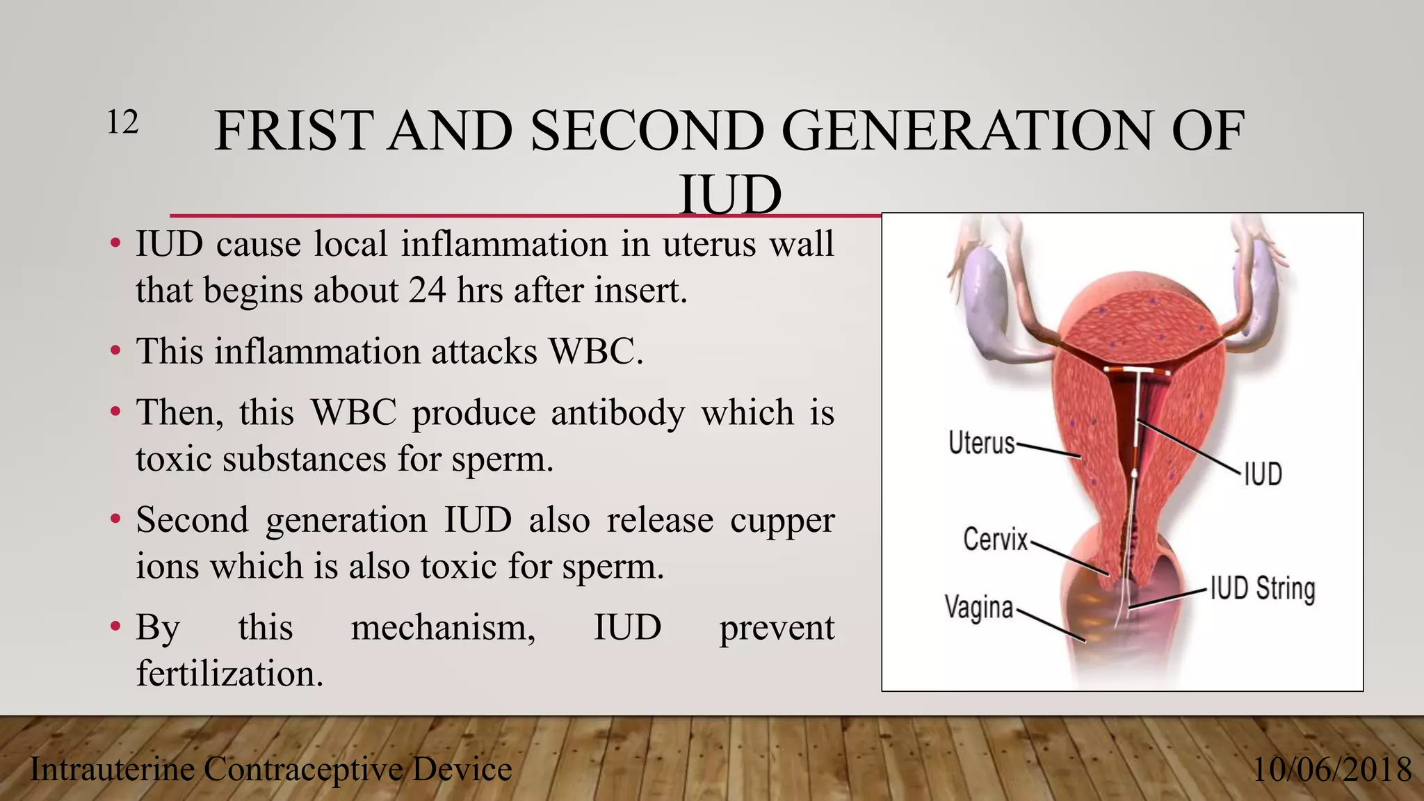 Intrauterine device (IUD) | PPTX