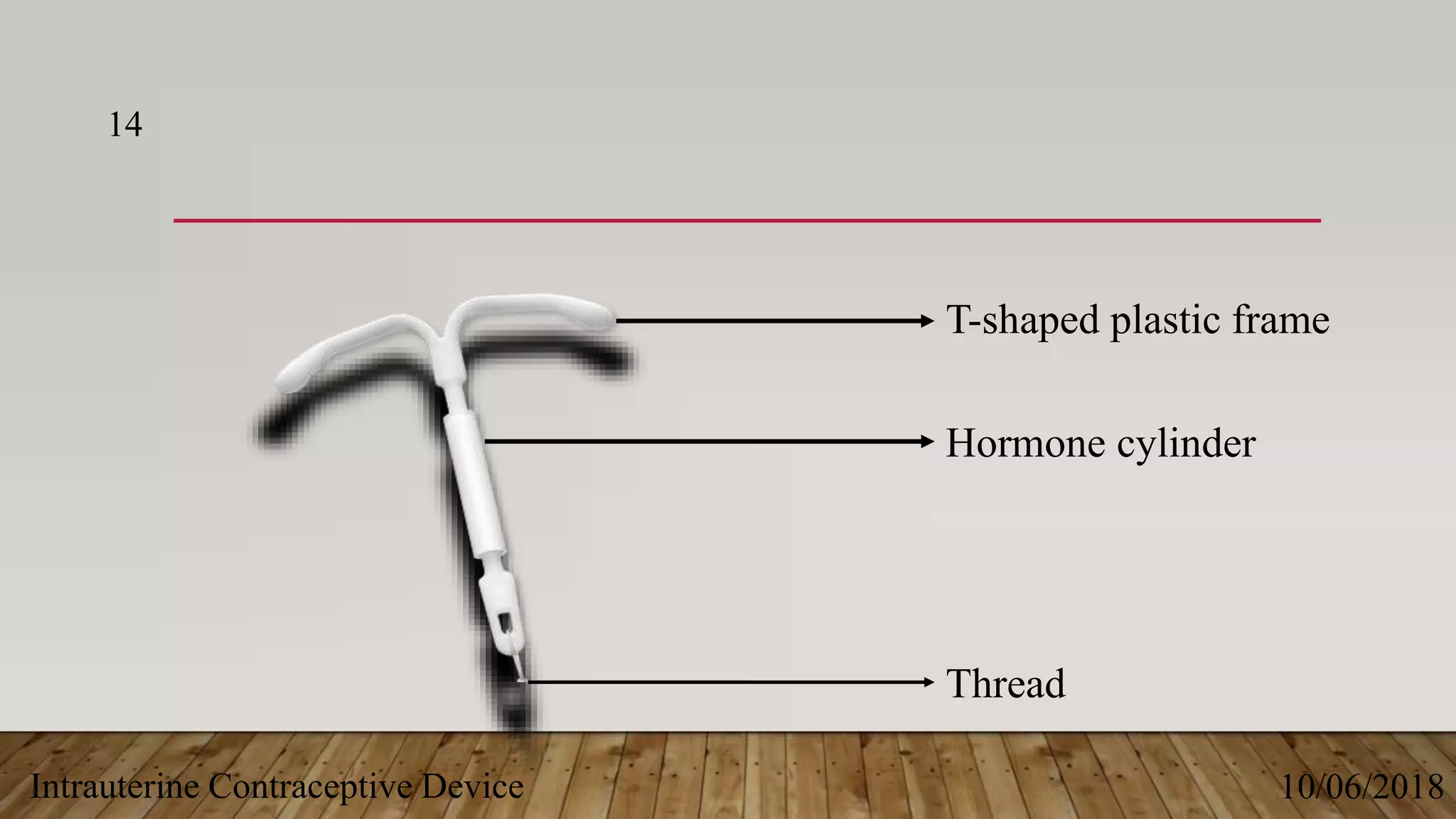 Intrauterine device (IUD) | PPTX