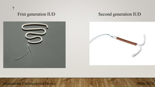 Intrauterine device (IUD) | PPTX