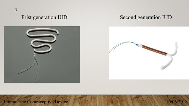 Intrauterine device (IUD)
