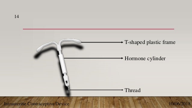 Intrauterine device (IUD)