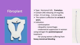 IUD.pptx | Birth Control | Reproductive Health