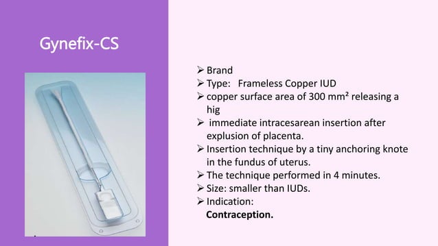 IUD.pptx | Birth Control | Reproductive Health