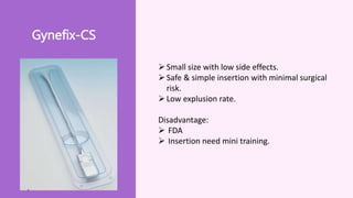 IUD.pptx | Birth Control | Reproductive Health