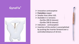 IUD.pptx | Birth Control | Reproductive Health