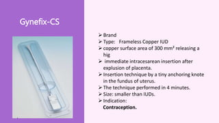 IUD.pptx