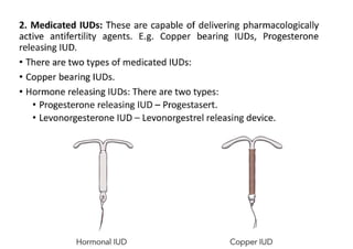 IUD.pptx