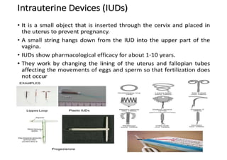 IUD.pptx