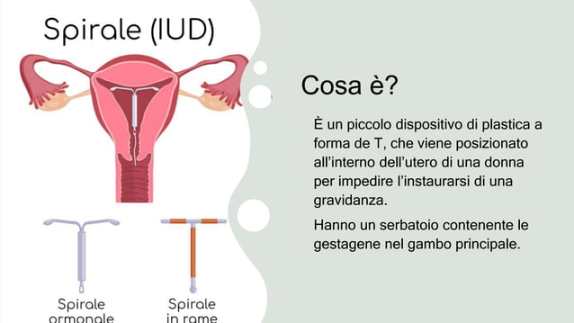 IUD Ormonale, Intra Uterine Device Spirale IUD | PPT