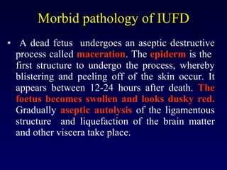 POST DATED PREGNANCY AND INTRA-UTERINE FETAL DEATH, IUFD, Mob ...