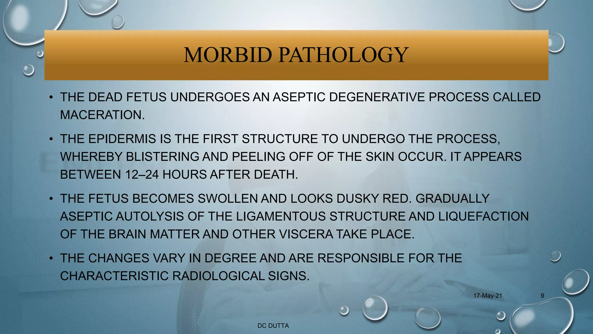 Intrauterine Fetal Death (IUFD) -EBM.pdf