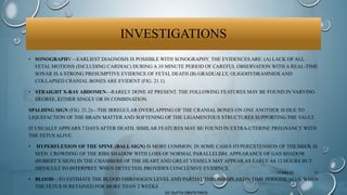 Intrauterine Fetal Death (IUFD) -EBM.pdf
