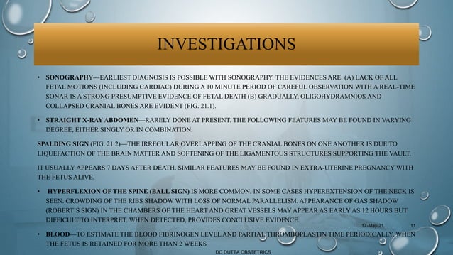 Intrauterine Fetal Death (IUFD) -EBM.pdf
