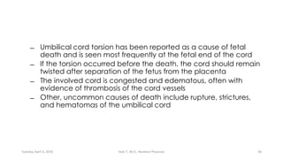 Intrauterine Fetal Death | PDF