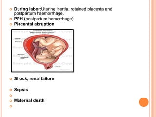 IUFD(INTRA UTERINE FETAL DEATH).pptx