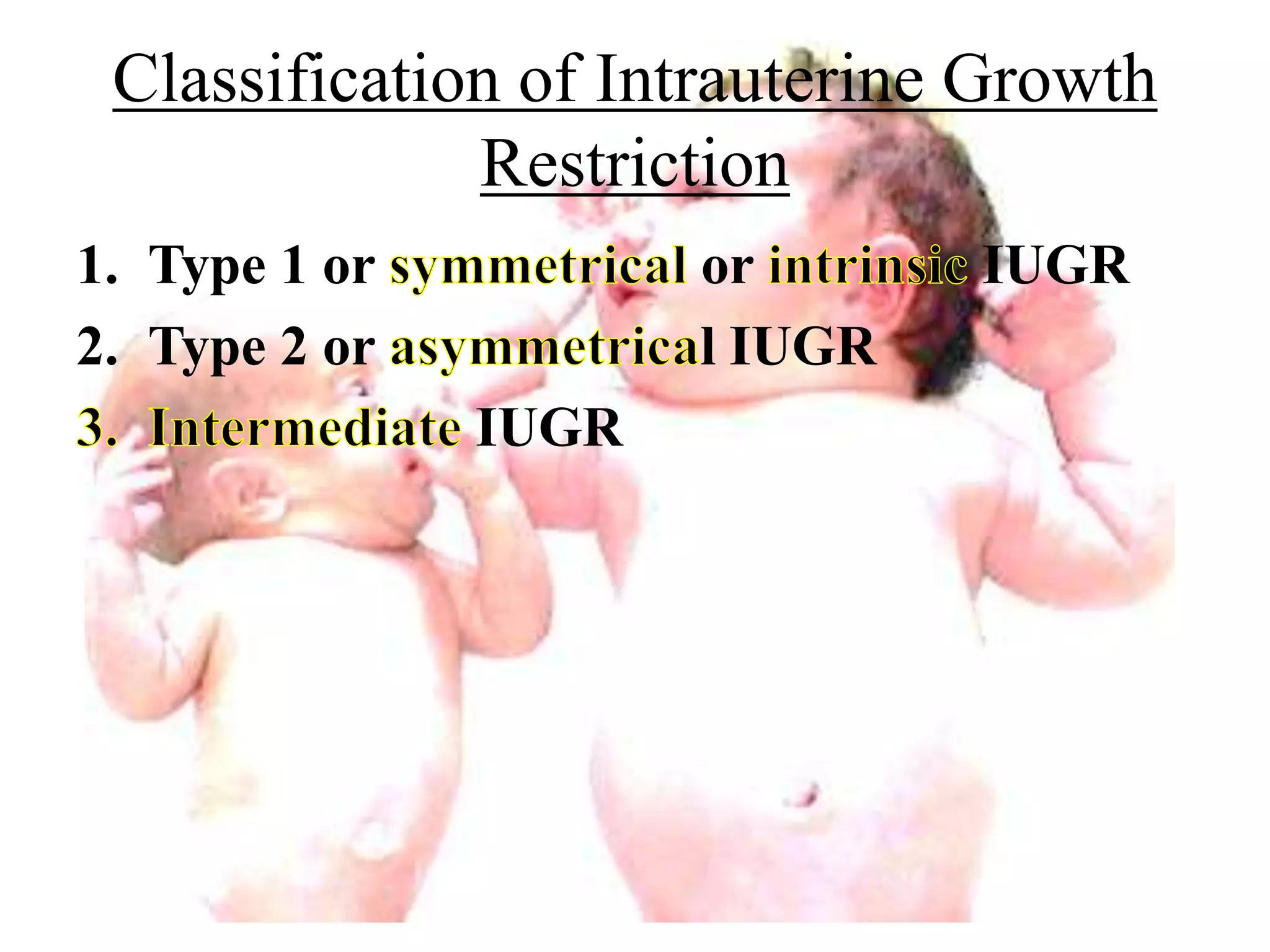 Aetiology and classification of IUGR by- ANANY GUPTA (KGMU) | PPTX